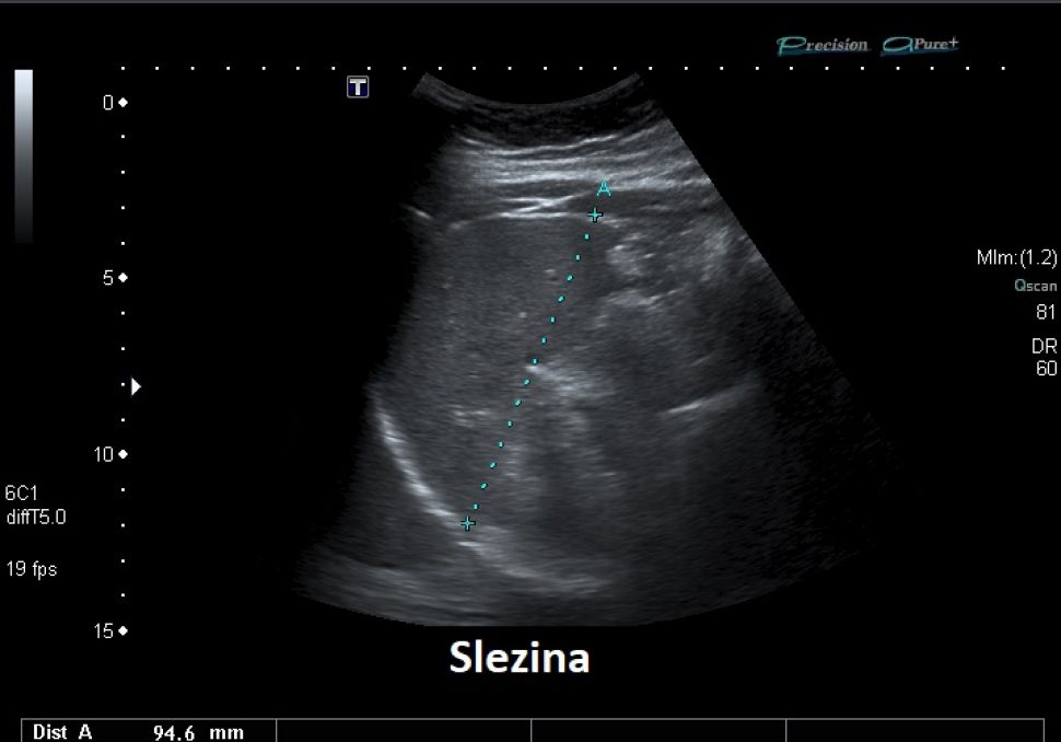 Postradatelný, ale přesto důležitý orgán – 21stoleti.cz